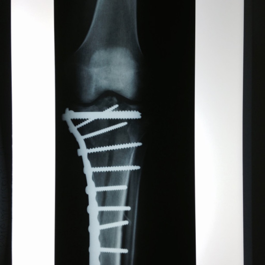 Ortopedie – Traumatologie – Kineto Promedica Life